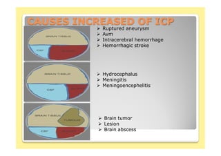Cerebrolspinal fluid (csf) and management of increased intracranial ...