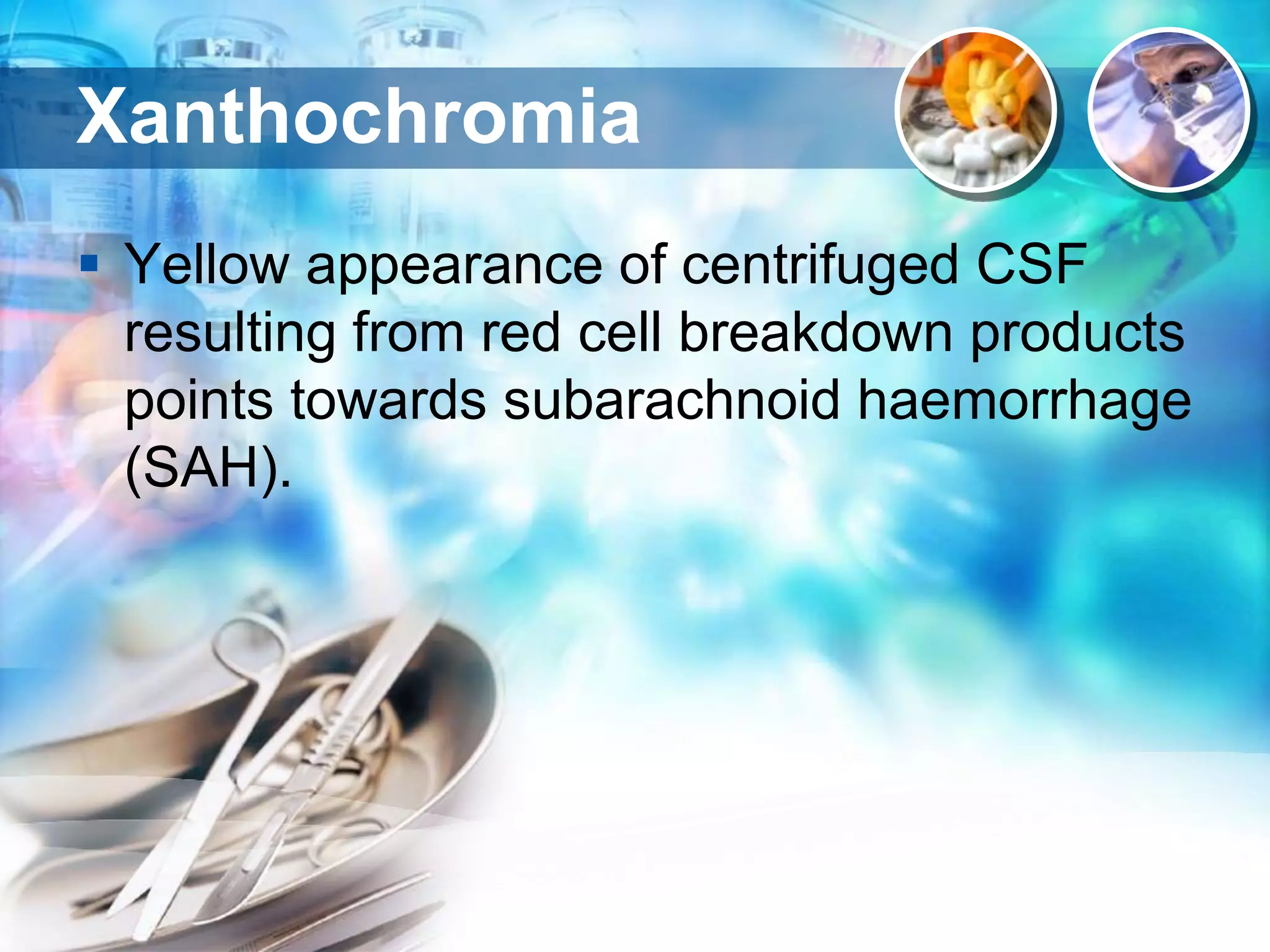 Cerebrospinal fluid | PPTX