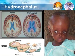 Cerebrospinal fluid | PPTX