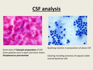 Cerebrospinal fluid | PPTX