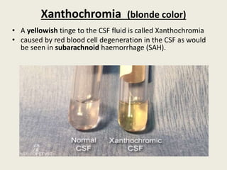 Cerebrospinal Fluid Color