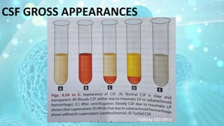CEREBROSPINAL FLUID - A BRIEF PPT FOR NURSING AND MBBS | PPTX | Brain ...