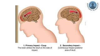 Cerebrospinal Fluid & Hydrocephalus.pdf | Brain and Nervous System Disorders | Diseases and ...