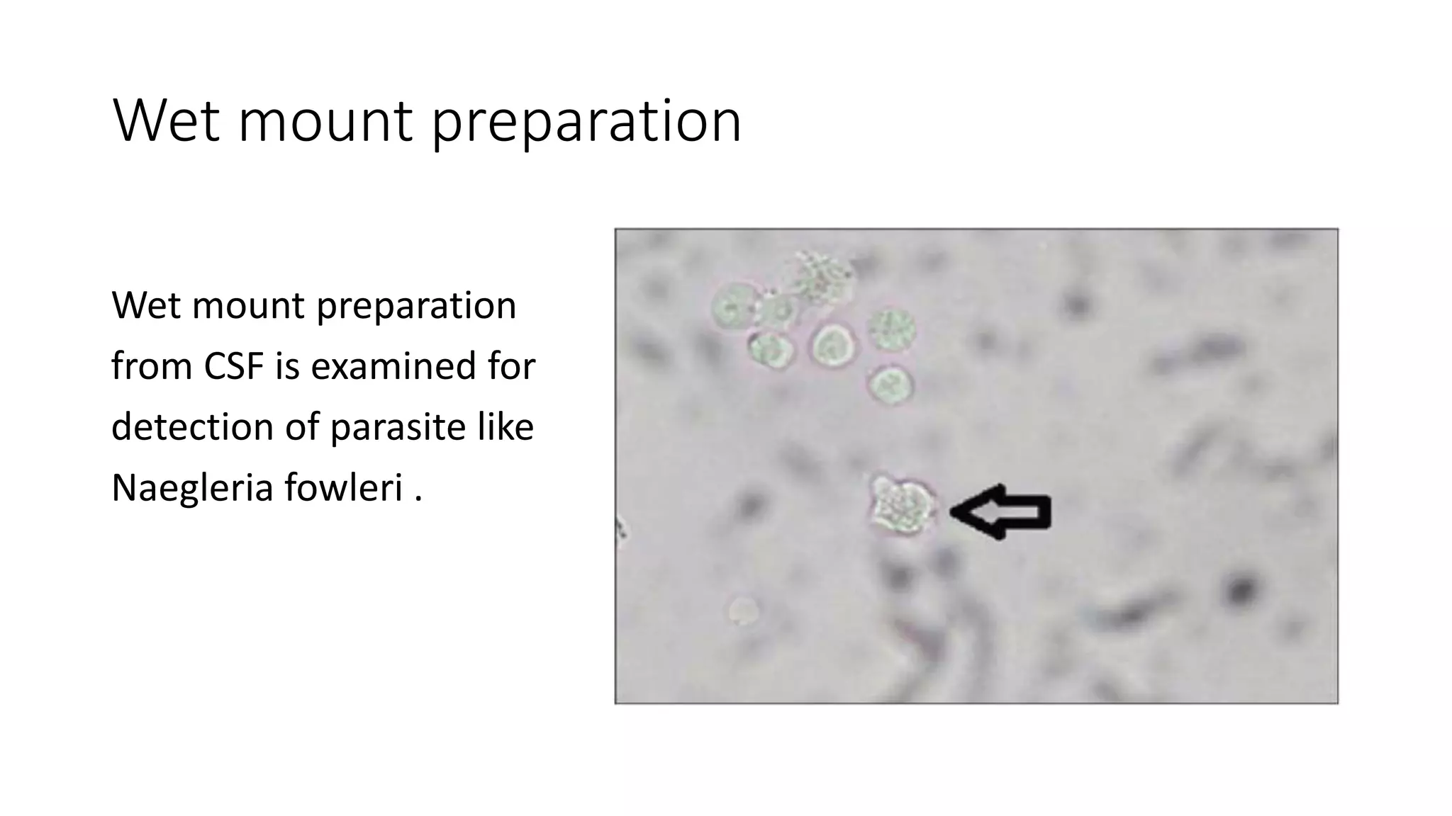 cerebrospinal fluid (1)11111.pptx