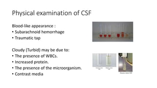 cerebrospinal fluid (1)11111.pptx