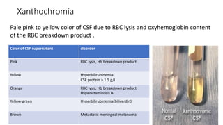 cerebrospinal fluid (1)11111.pptx