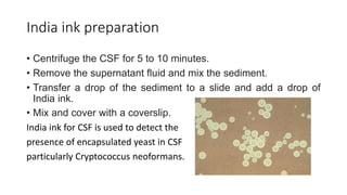 cerebrospinal fluid (1)11111.pptx
