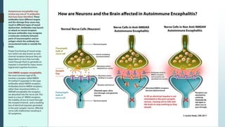 Cerebrospinal fluid analysis(Neurology) | PPT