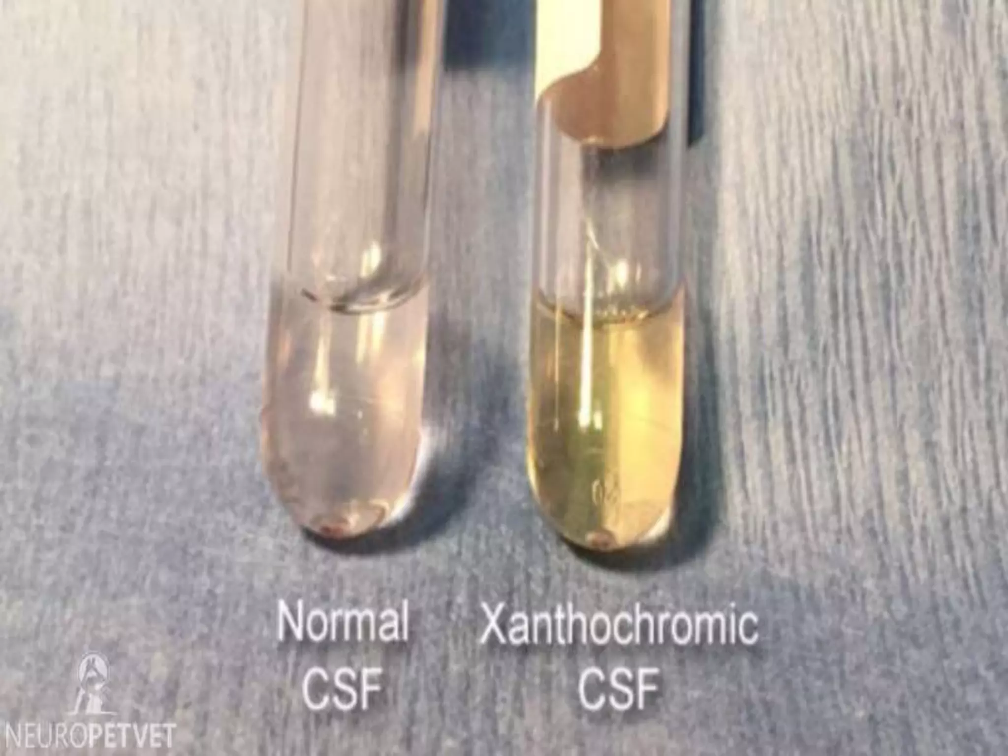 Cerebrospinal fluid (csf) examination under microscope | PPTX