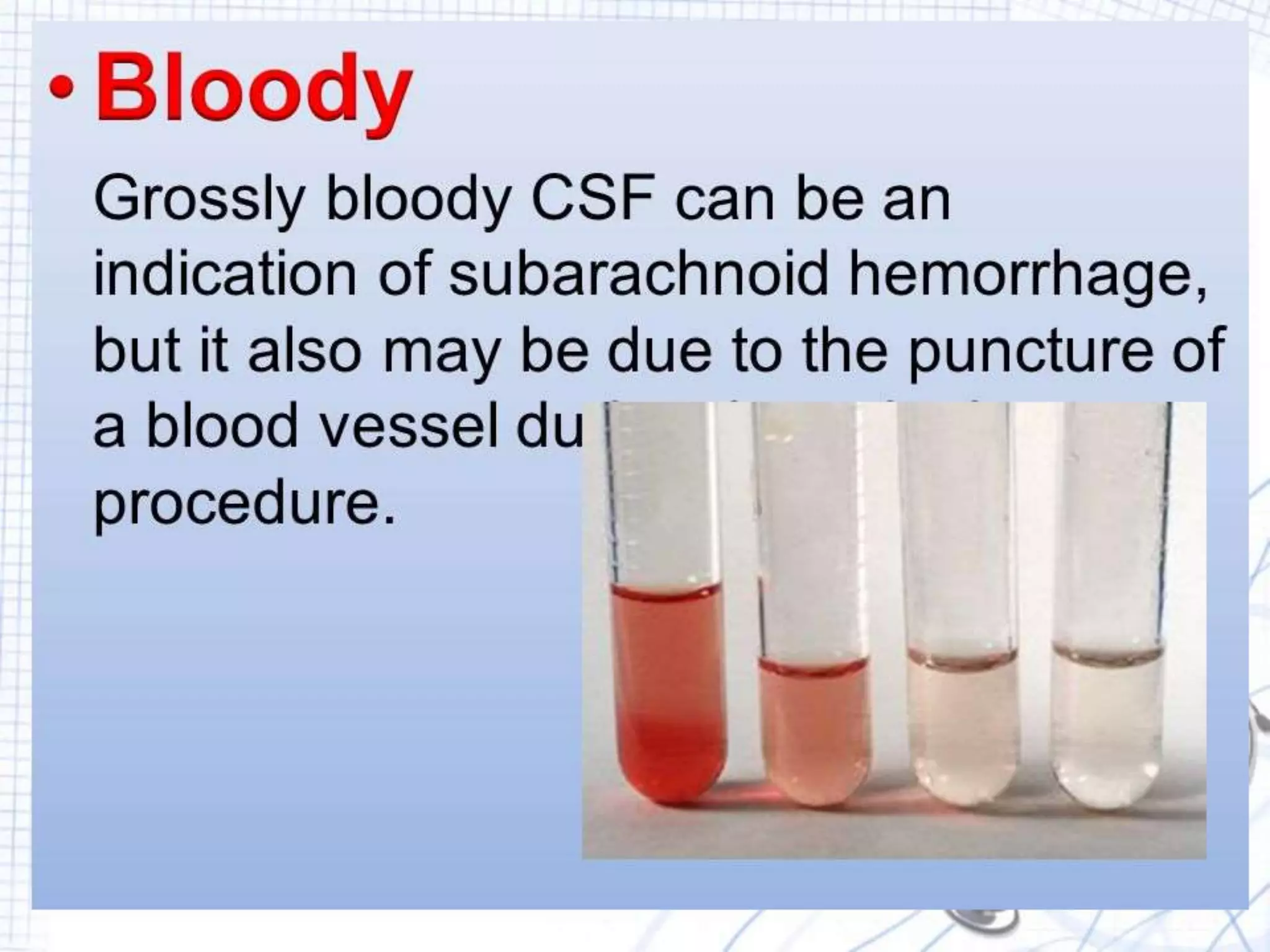 Cerebrospinal fluid (csf) examination under microscope | PPTX