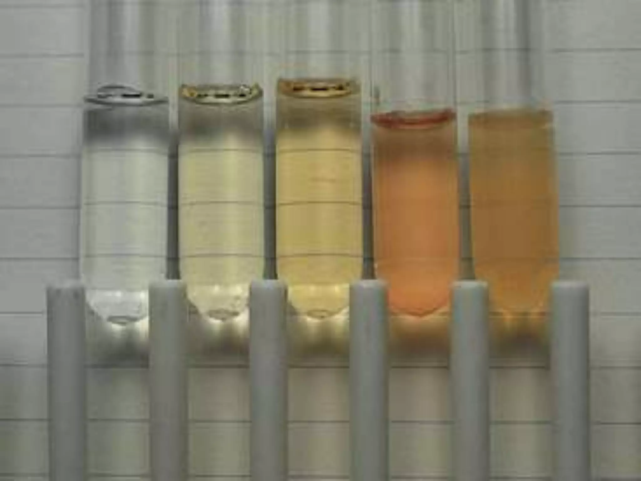 Cerebrospinal fluid (csf) examination under microscope | PPTX