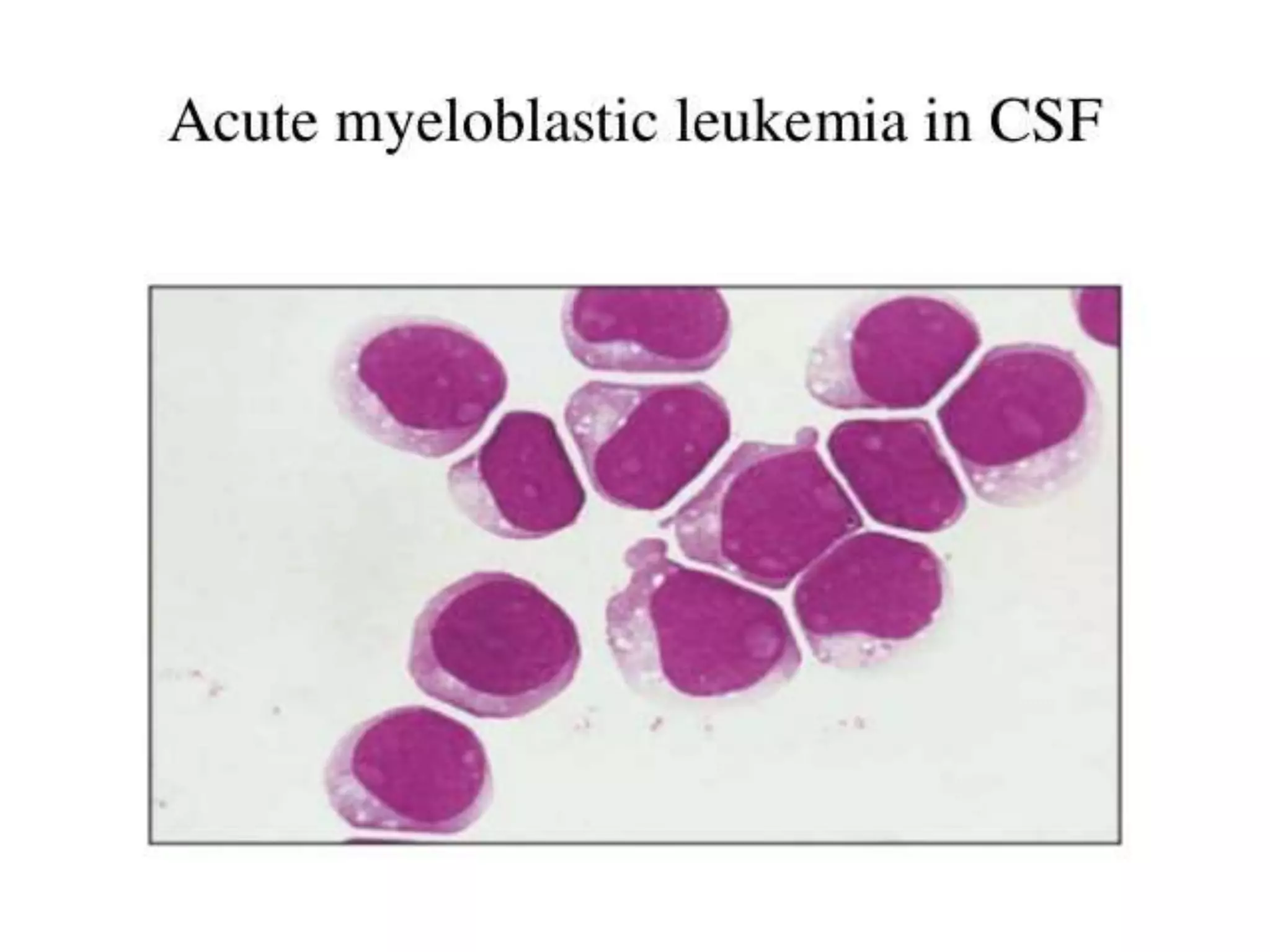 Cerebrospinal fluid (csf) examination under microscope | PPTX