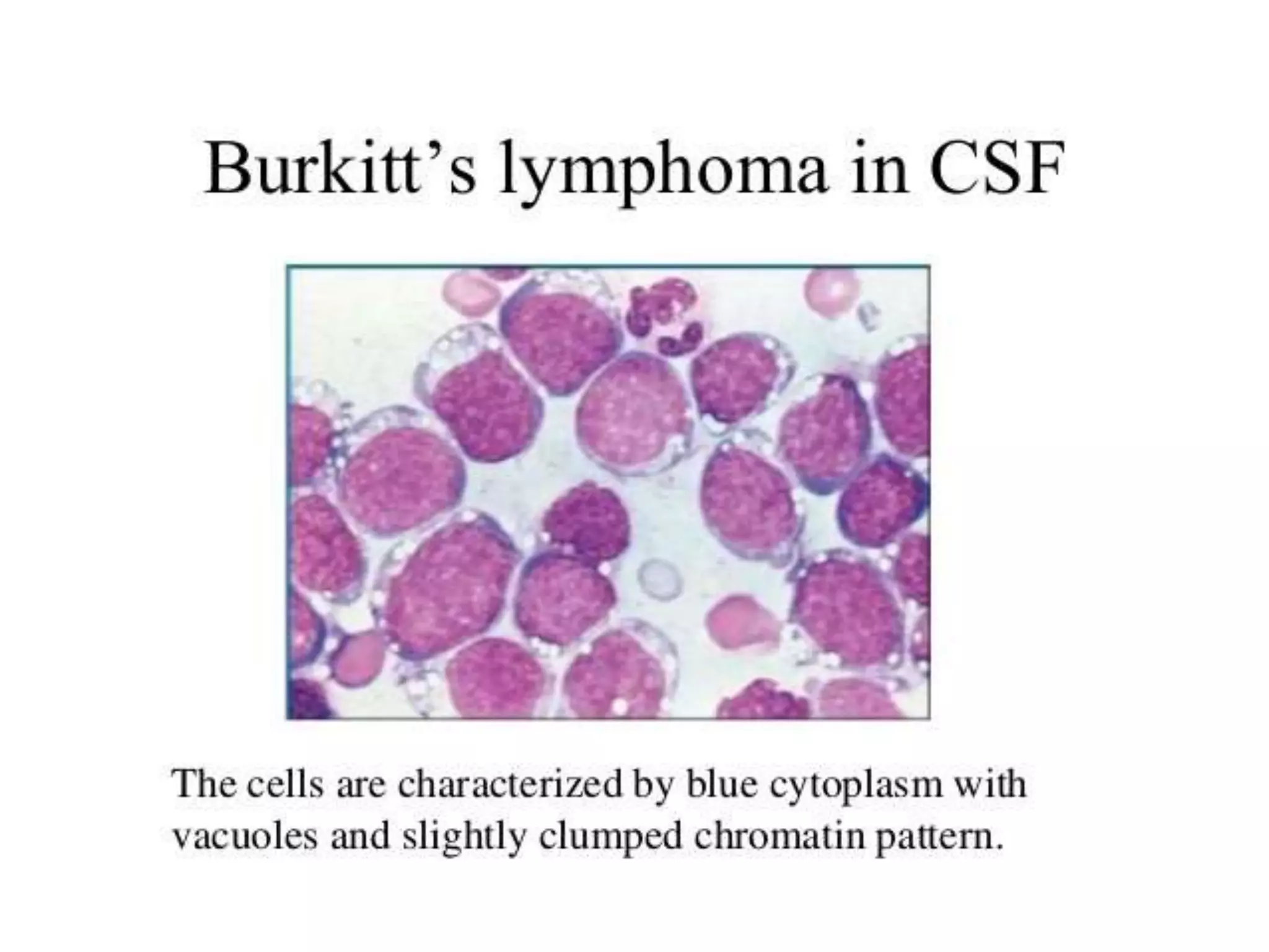 Cerebrospinal fluid (csf) examination under microscope | PPTX