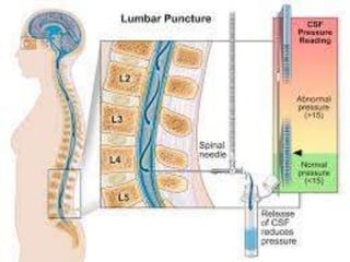 Cerebrospinal fluid (csf) examination under microscope | PPTX