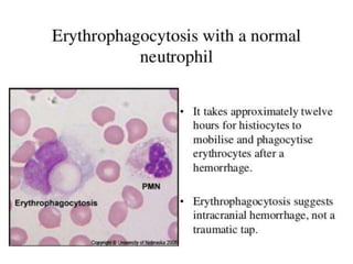 Cerebrospinal fluid (csf) examination under microscope | PPTX