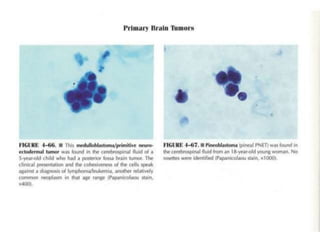 Cerebrospinal fluid (csf) examination under microscope | PPTX