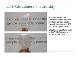 Cerebrospinal fluid (csf) examination under microscope | PPTX