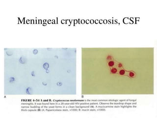 Cerebrospinal fluid (csf) examination under microscope | PPTX