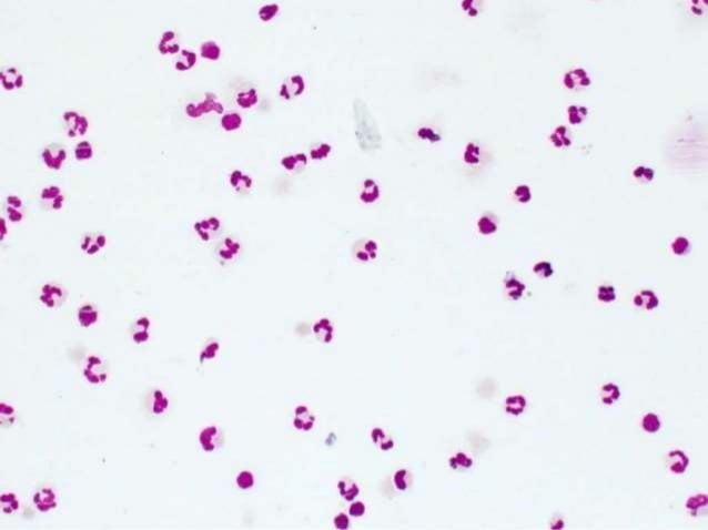 Cerebrospinal fluid (csf) examination under microscope | PPT