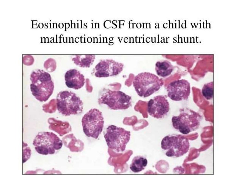 Cerebrospinal fluid (csf) examination under microscope