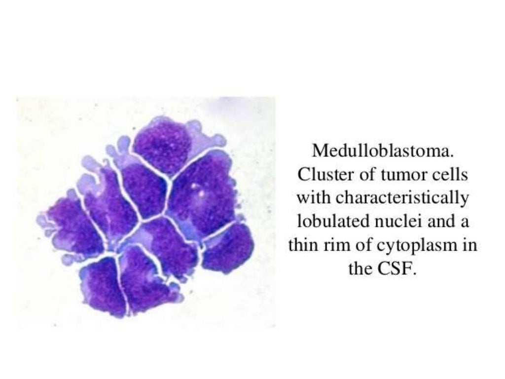 Cerebrospinal fluid (csf) examination under microscope