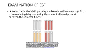 CEREBROSPINAL FLUID IN HEALTH AND DISEASE.pptx