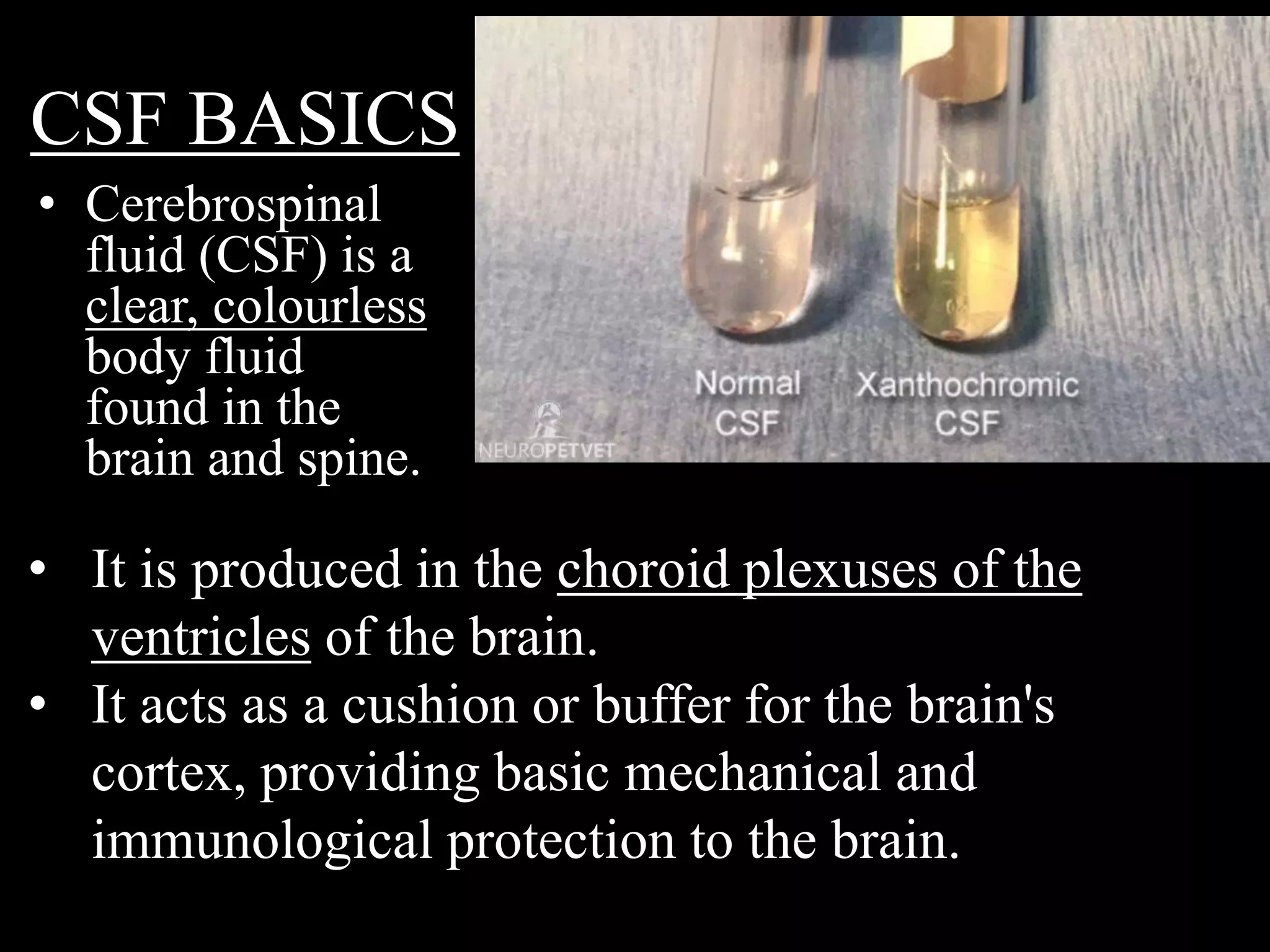 Cerebrospinal fluid rhinorrhea (CSF) | PPTX