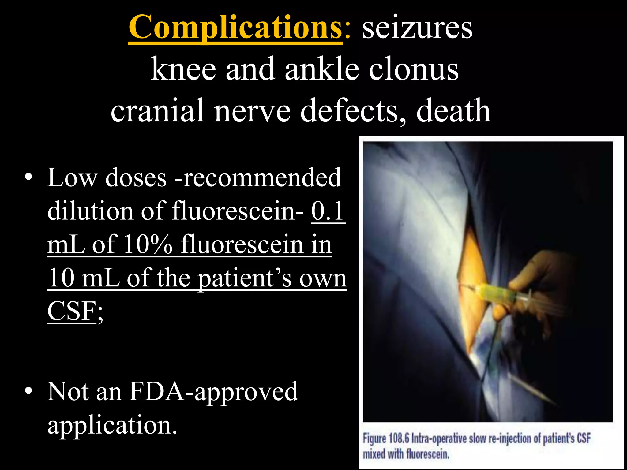 Cerebrospinal fluid rhinorrhea (CSF) | PPTX