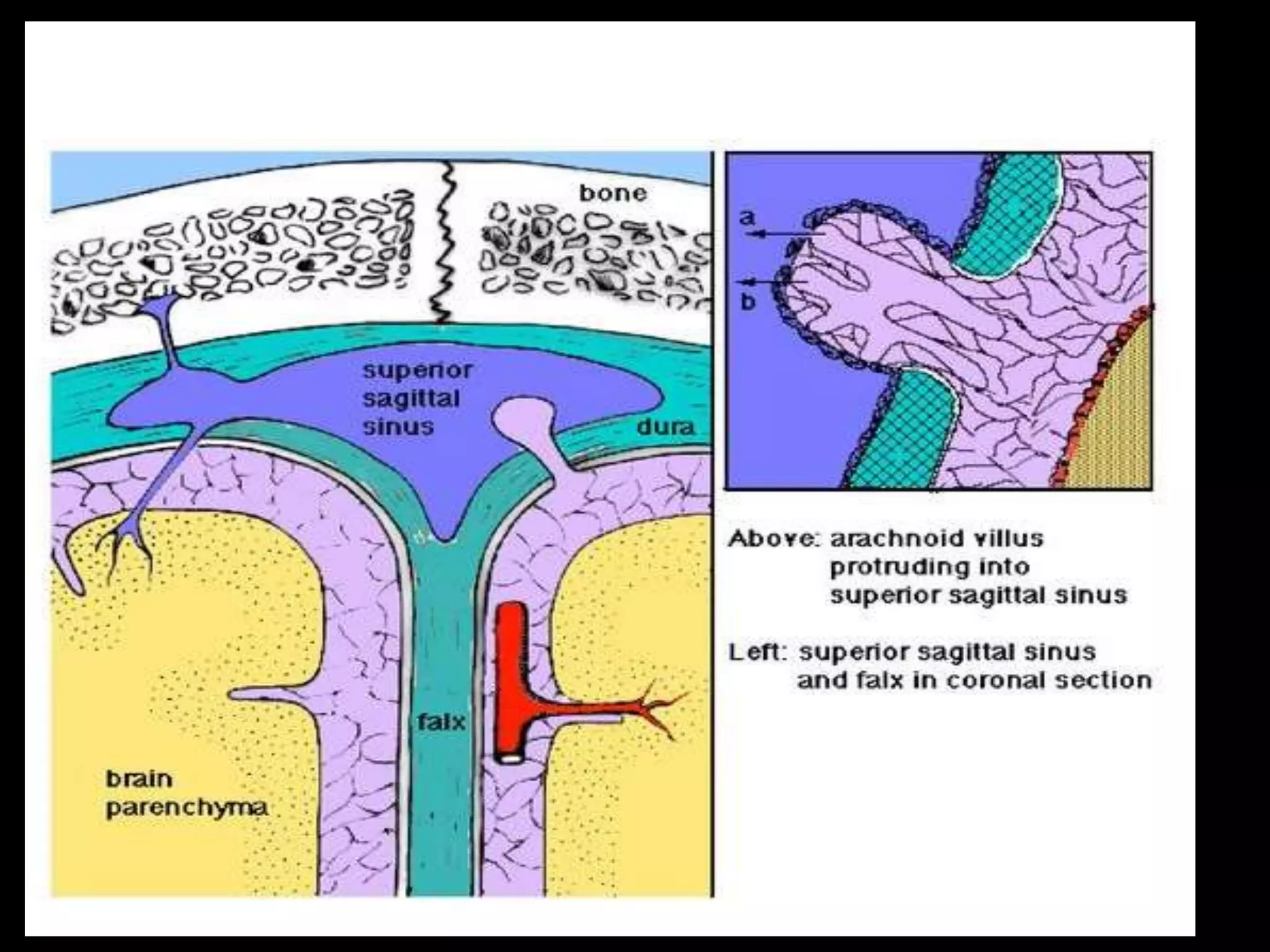 Cerebrospinal fluid rhinorrhea (CSF) | PPTX