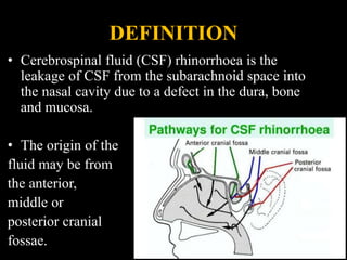 Cerebrospinal fluid rhinorrhea CSF PPT