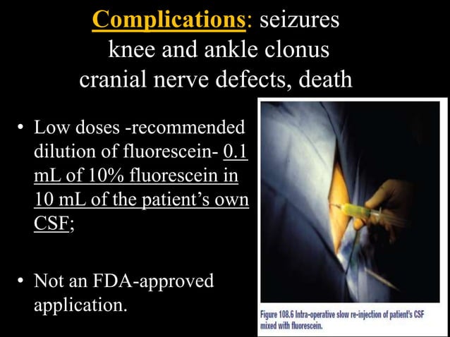 Cerebrospinal fluid rhinorrhea (CSF) | PPTX | Death, Injury, or ...