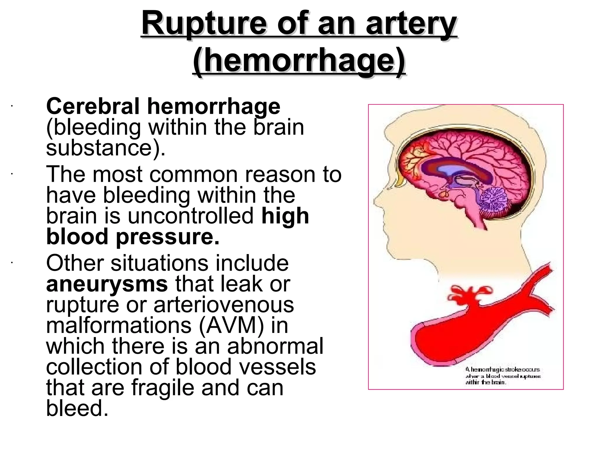 Cerebrovascular Accident (CVA) | PPT