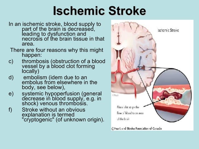 Cerebrovascular Accident (CVA) | PPT