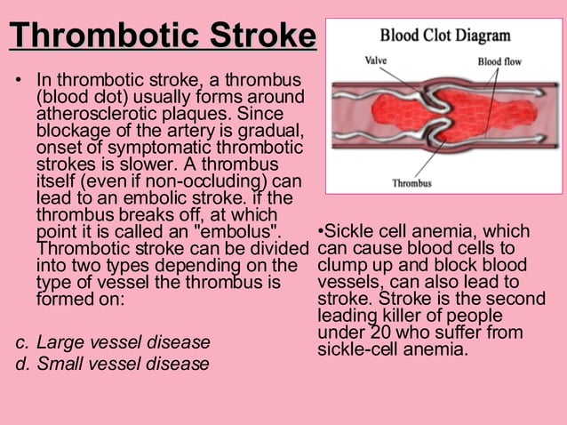 Cerebrovascular Accident (CVA) | PPT