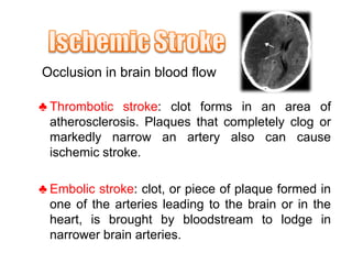 Cerebrovascular accident | PPTX