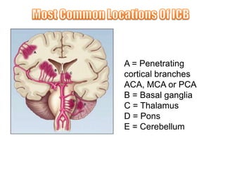 Cerebrovascular accident | PPTX