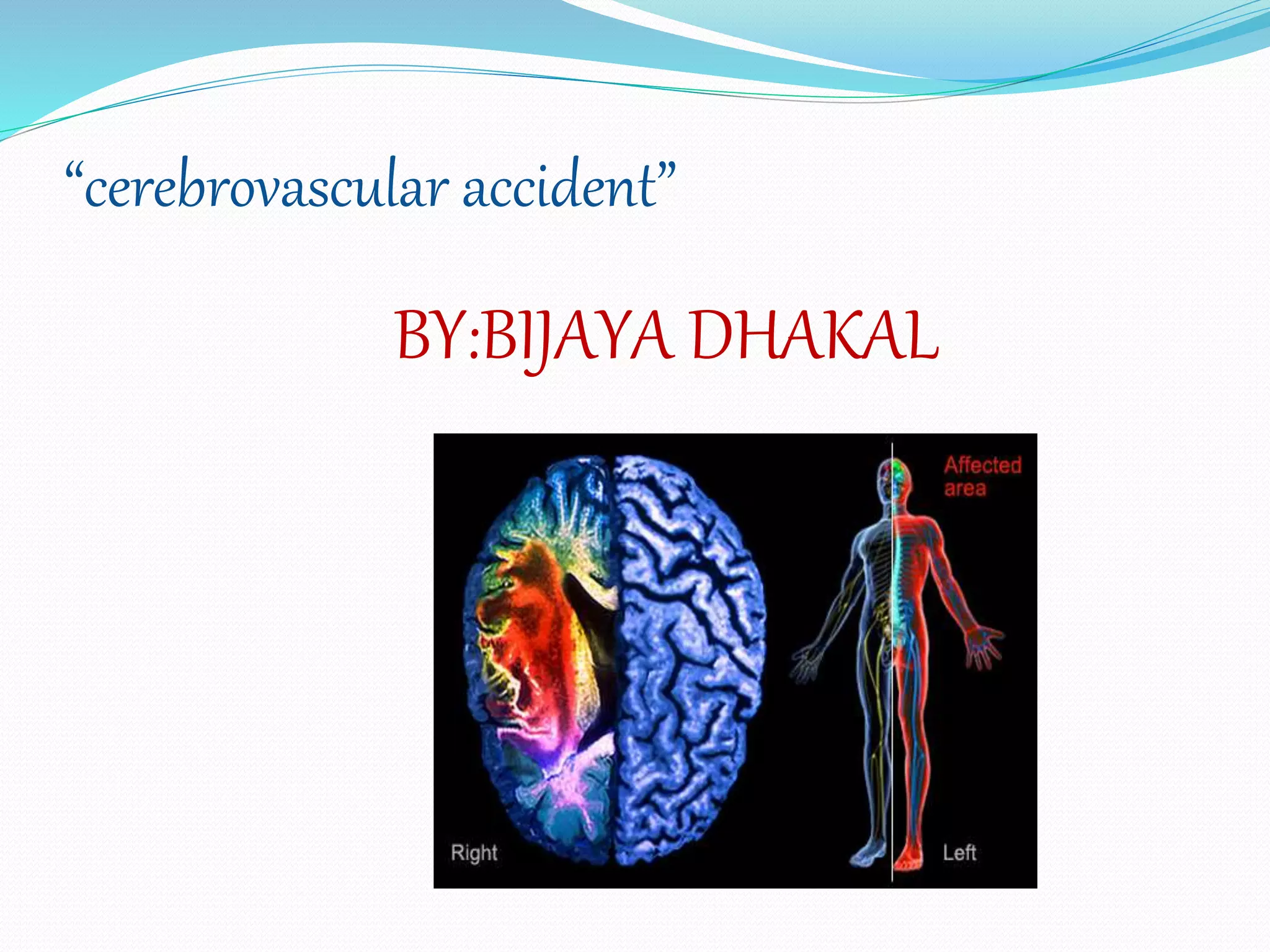 Cerebrovascular accident | PPTX