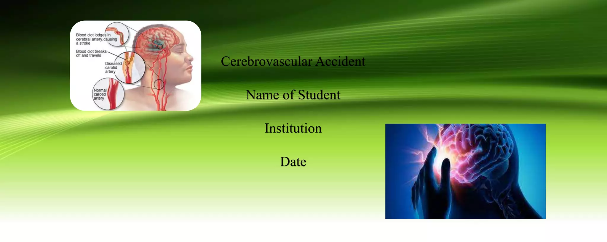 Cerebrovascular Accident.pptx