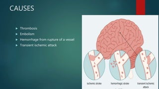 CEREBROVASCULAR ACCIDENT.pptx