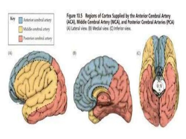 Localisation of stroke | PPTX