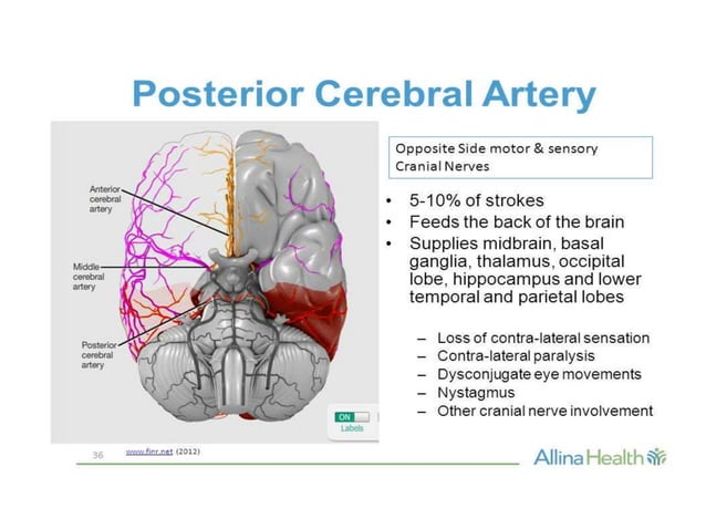 Localisation of stroke | PPTX