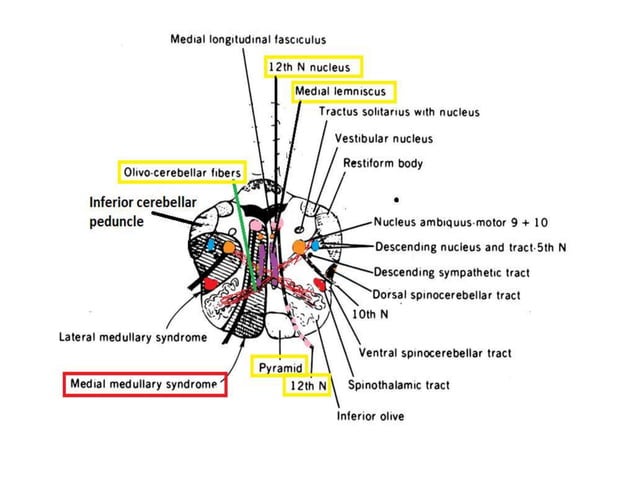 Localisation of stroke | PPTX
