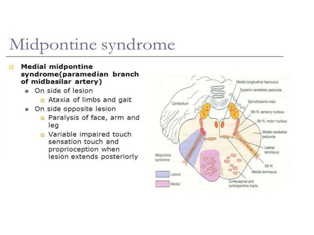 Localisation of stroke | PPTX