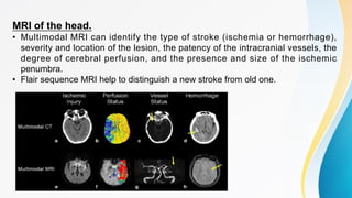 CEREBROVASCULAR _ ACCIDENT/STROKE - PDF / PPT | PDF