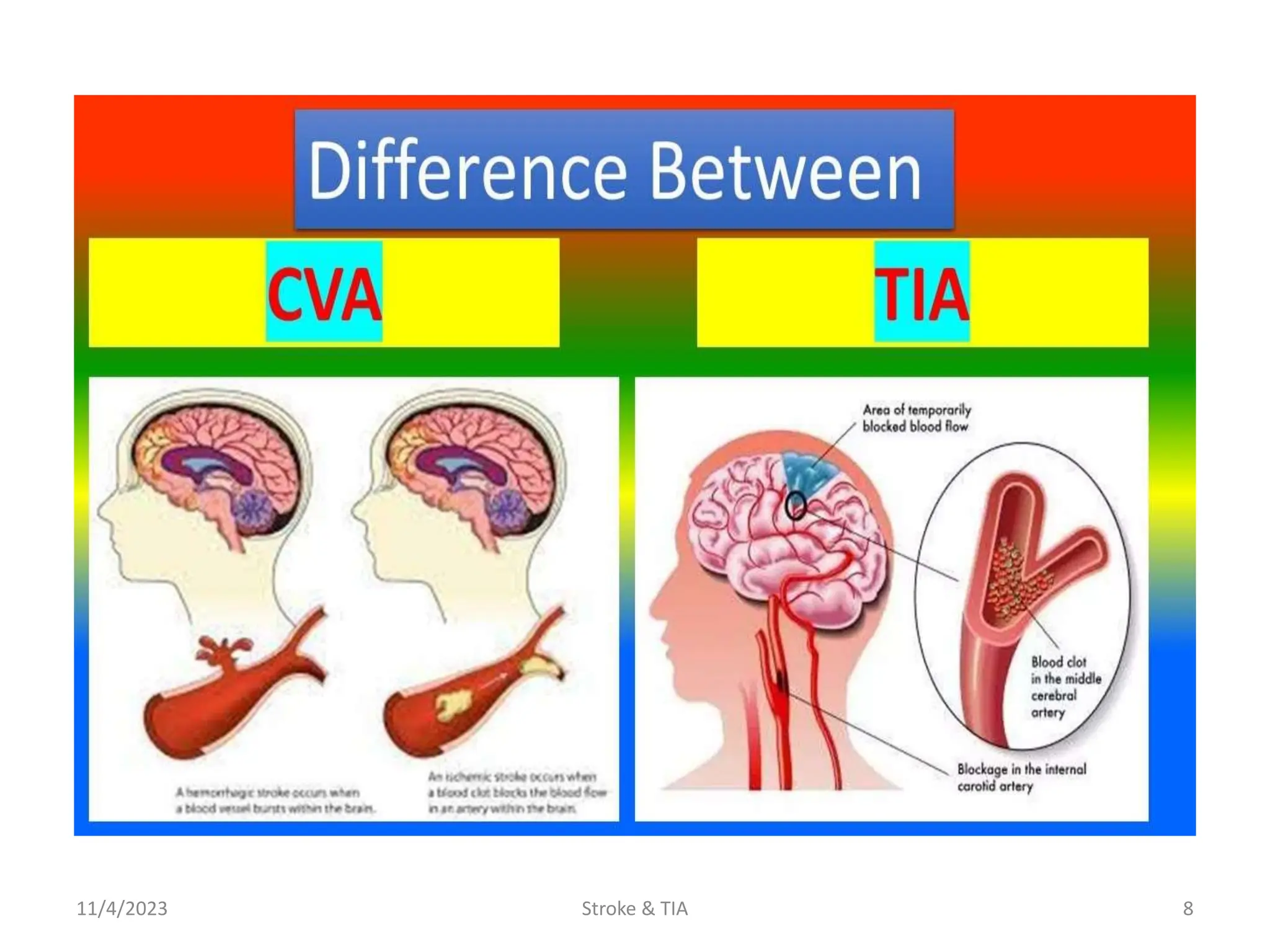 Cerebrovascular Accident &TIA.pptx