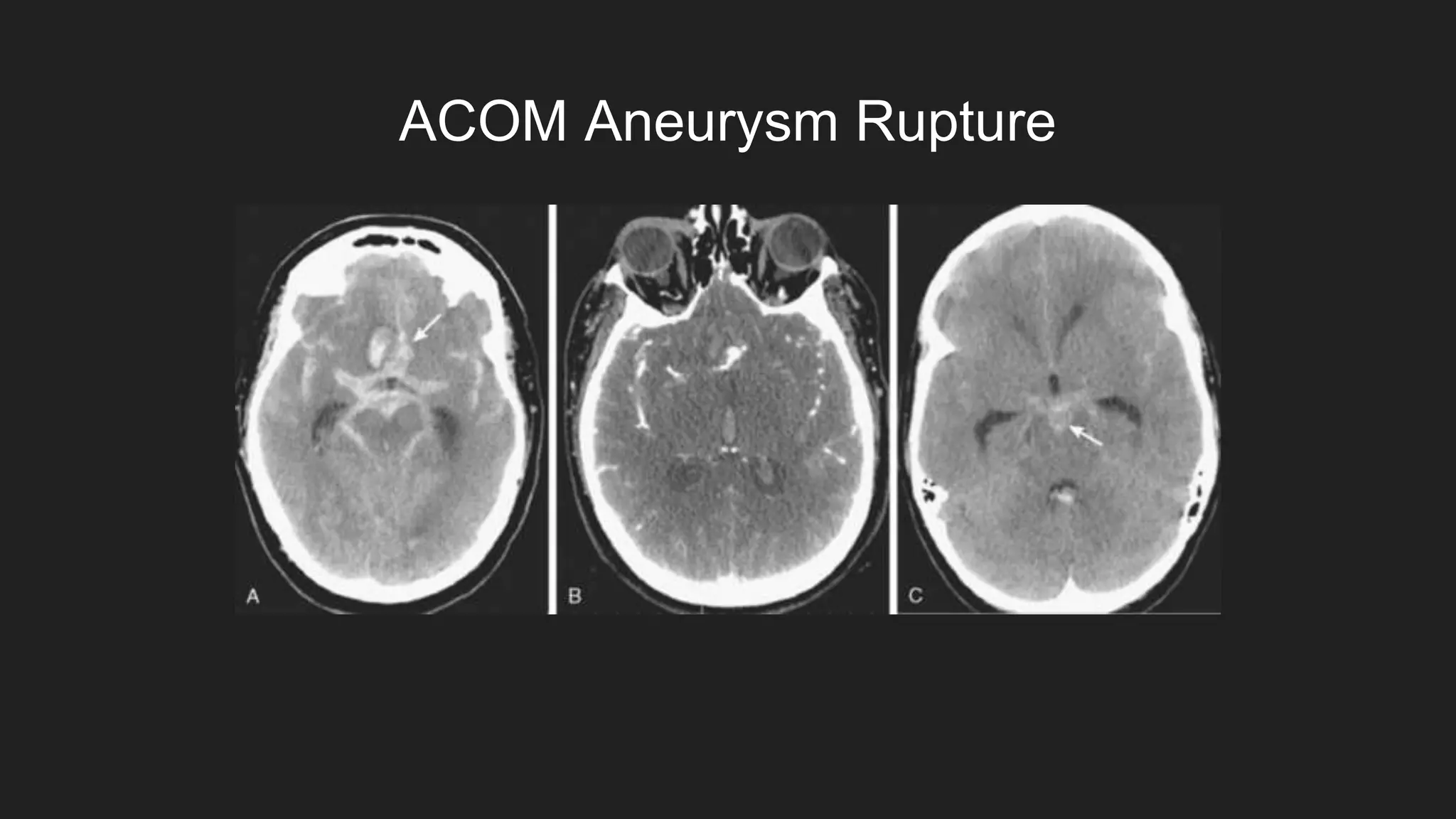 Cerebrovascular anatomy | PPTX