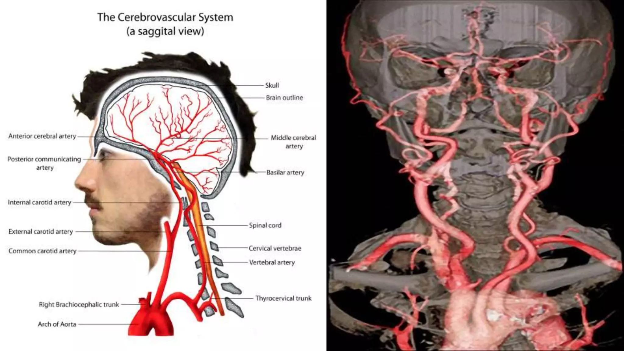 Cerebrovascular anatomy | PPTX