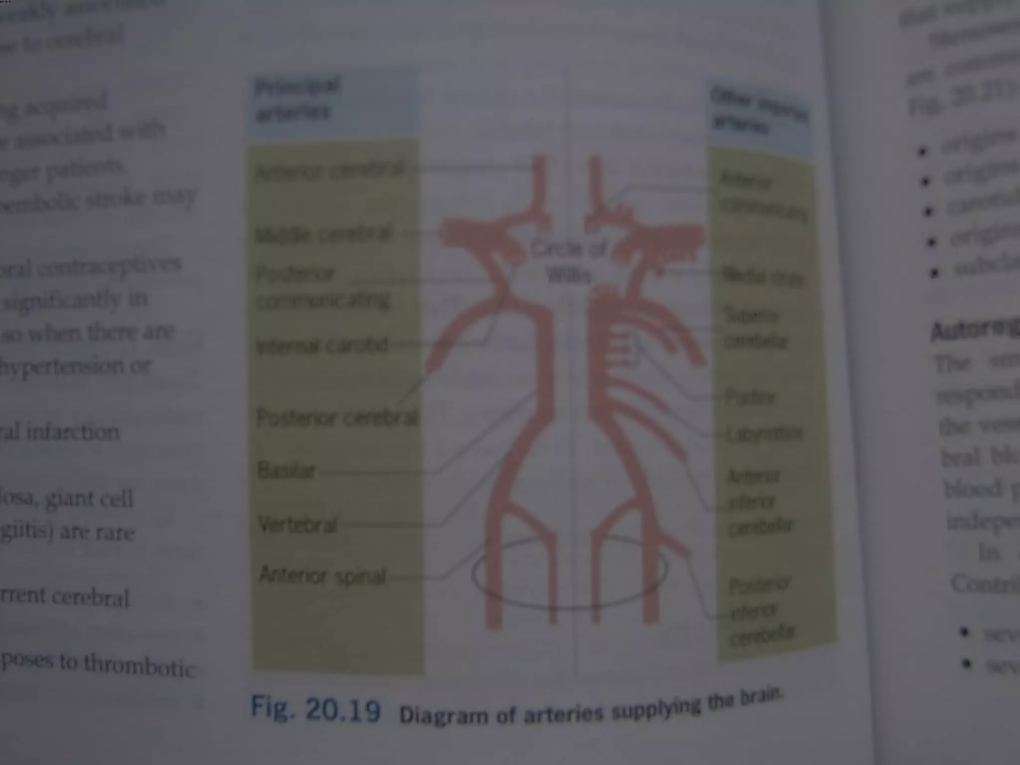 Cerebrovascular Disease Ppt
