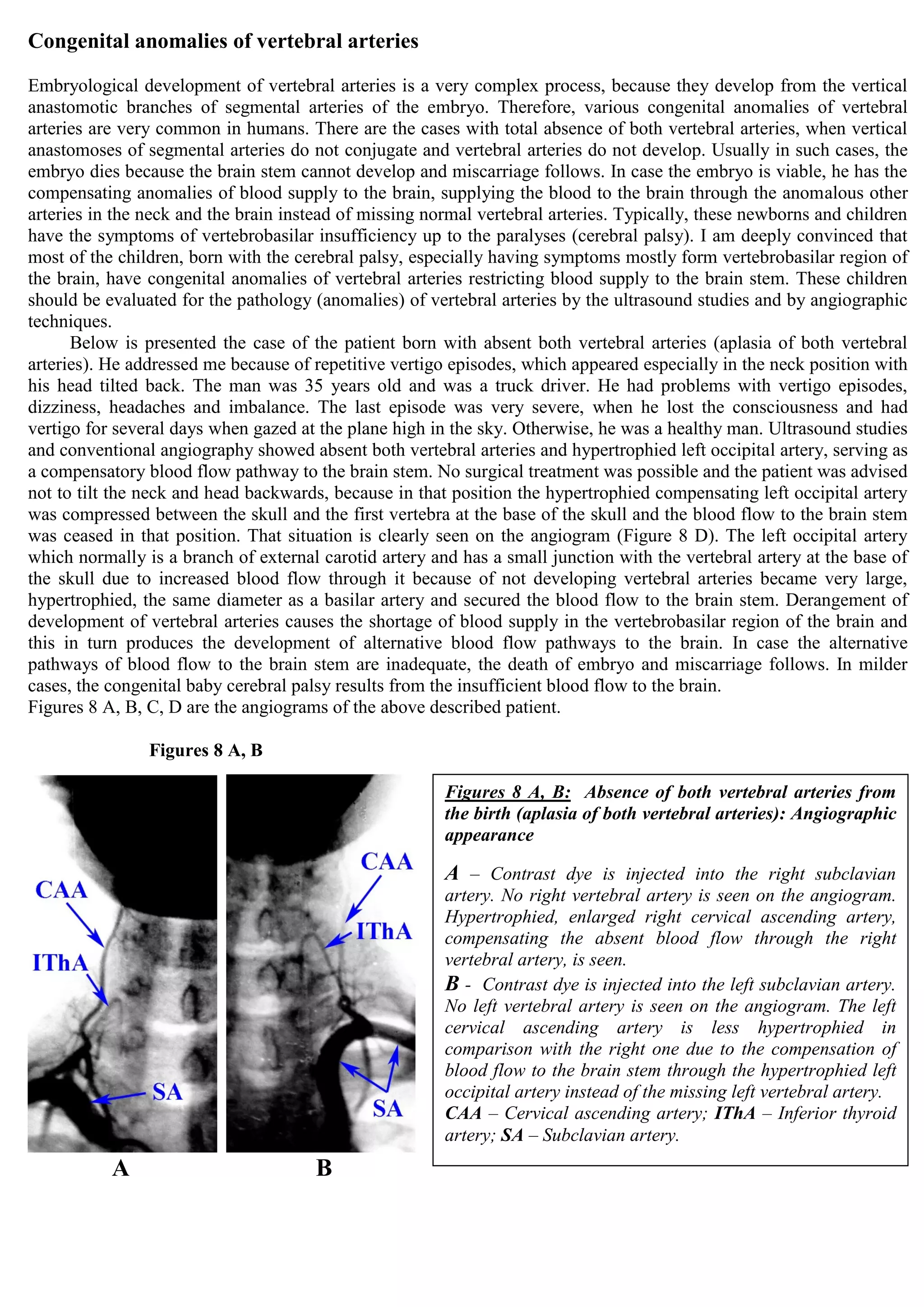 Cerebrovascular Disease, Cerebrovascular Insufficiency, Vertebrobasilar ...