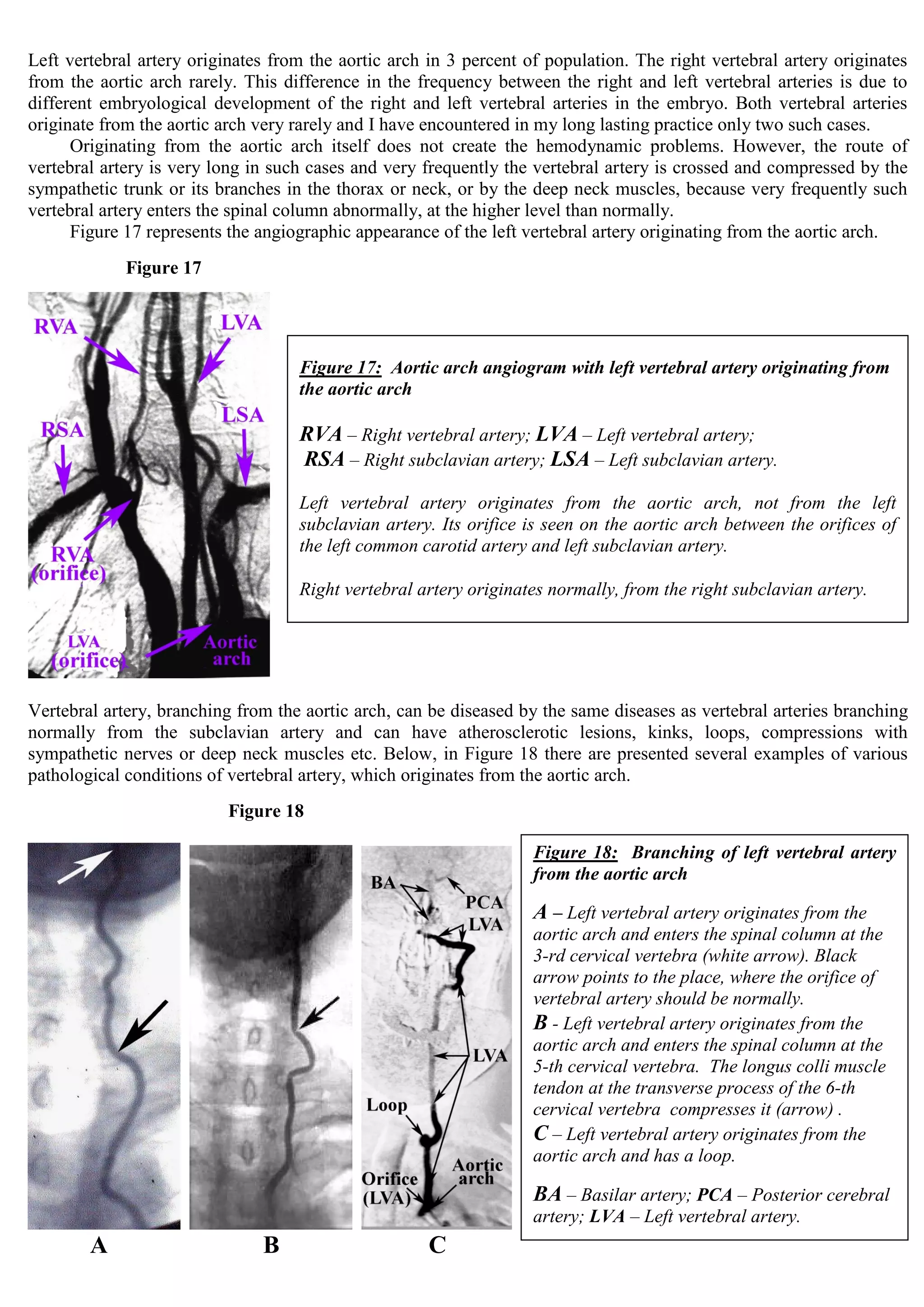 Cerebrovascular Disease, Cerebrovascular Insufficiency, Vertebrobasilar ...